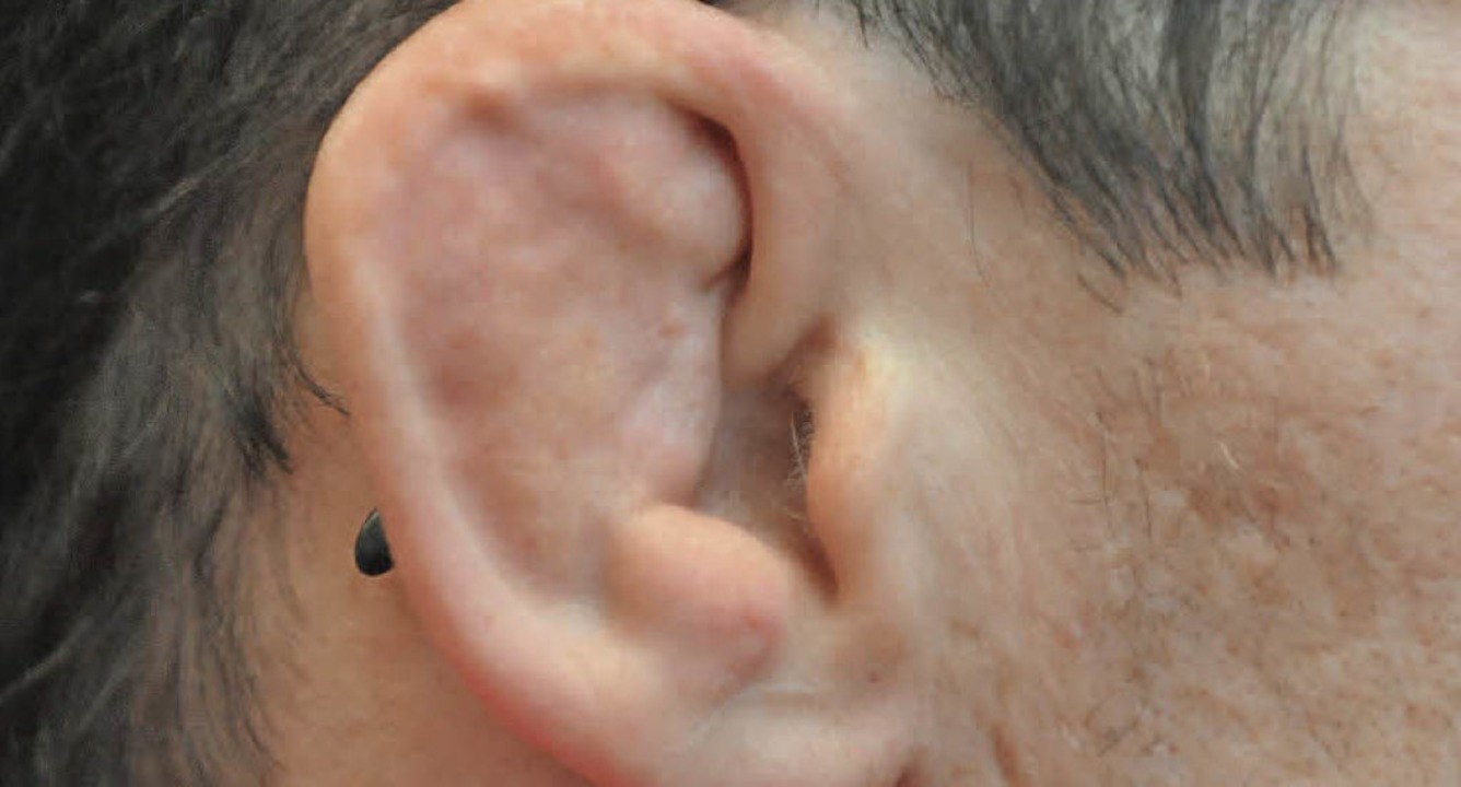 Erklär's mir: Was sind und wie kommt es zu Blumenkohlohren? - Ringen ...